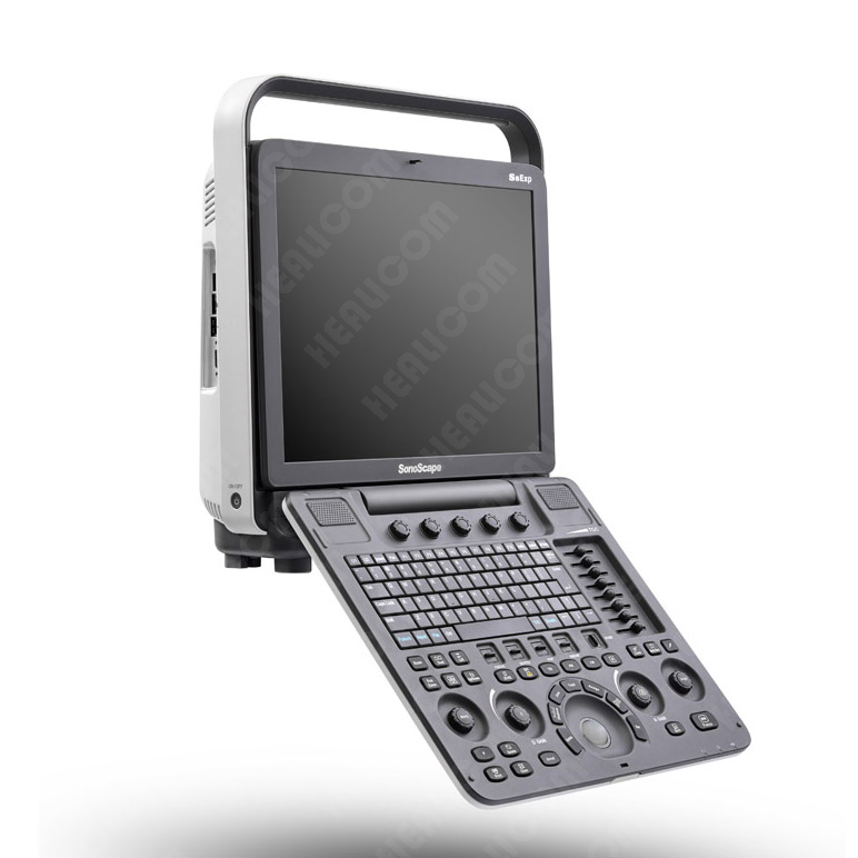Sonoscape S8 Exp Potable 4D Color Doppler Ultrasound Machine from China ...